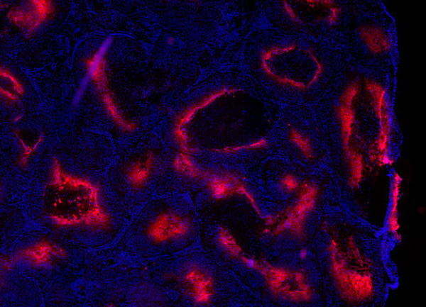 Hypoxyprobe Kits (MAb) – 亞旭生物科技