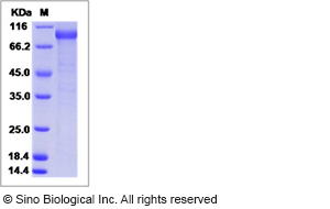 Human FMOD / fibromodulin Protein (Fc Tag) – 亞旭生物科技