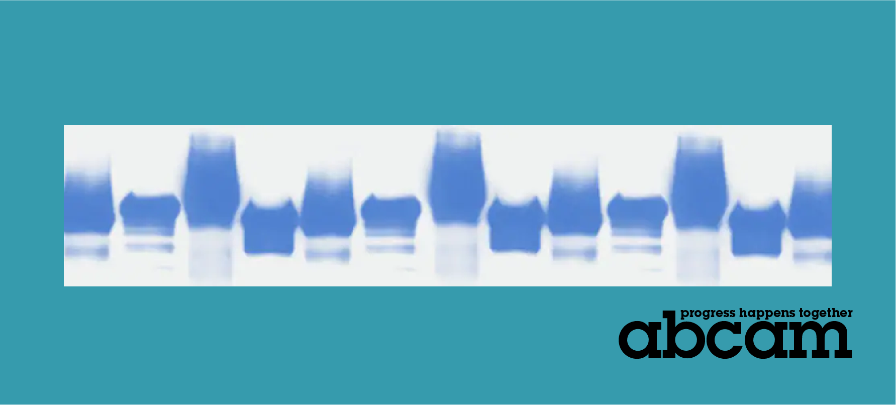 Abcam | Western Blot樣品製備-Lysis buffer選擇大不同 – 亞旭生物科技